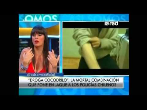 “Cocodrilo”: la droga que hace que la piel se caiga está en Chile - La Red