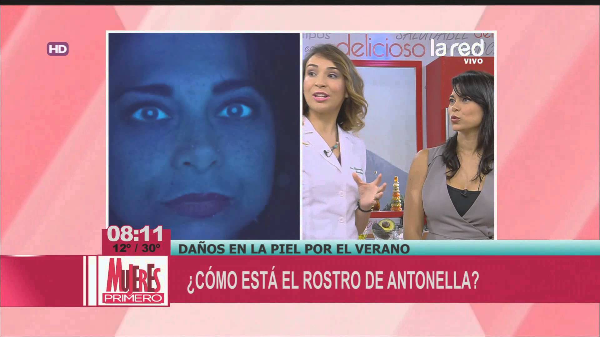 La Red - Las consecuencias de exponerse al sol