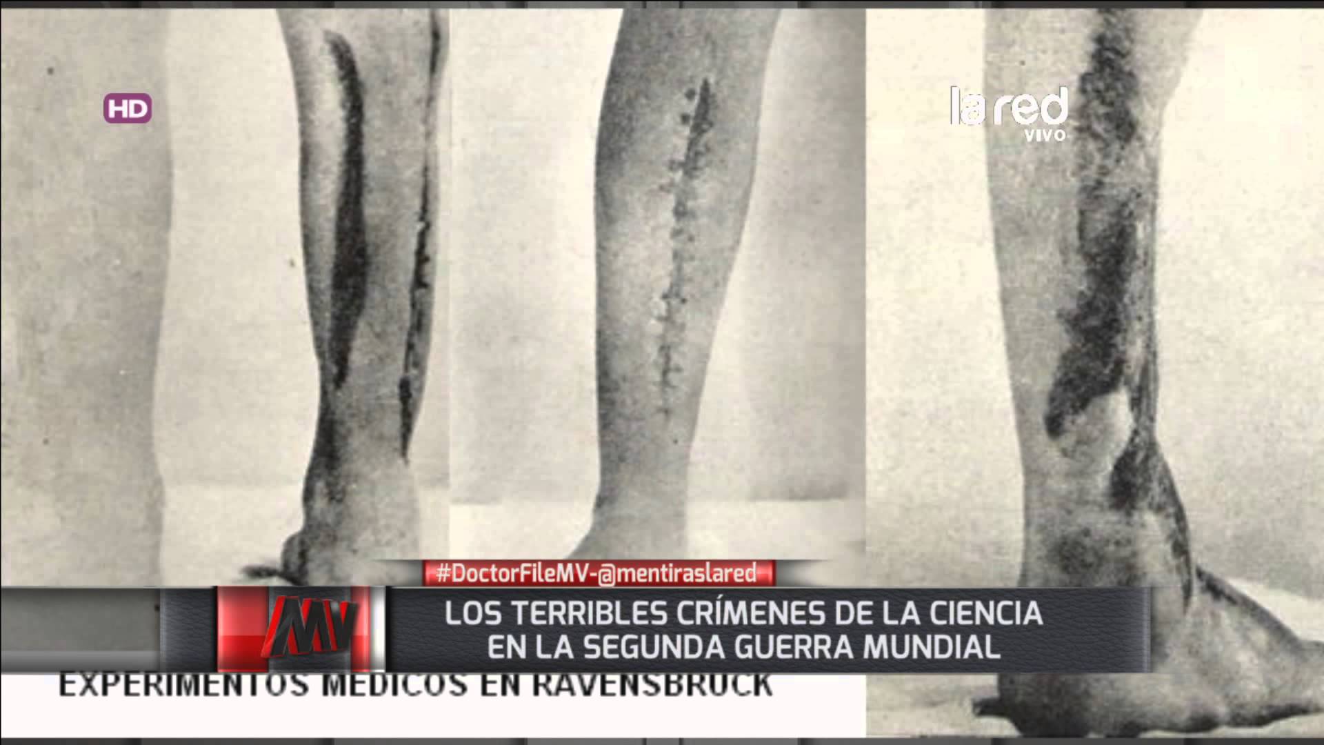 Doctor File nos presenta los experimentos traumatológicos de los nazi