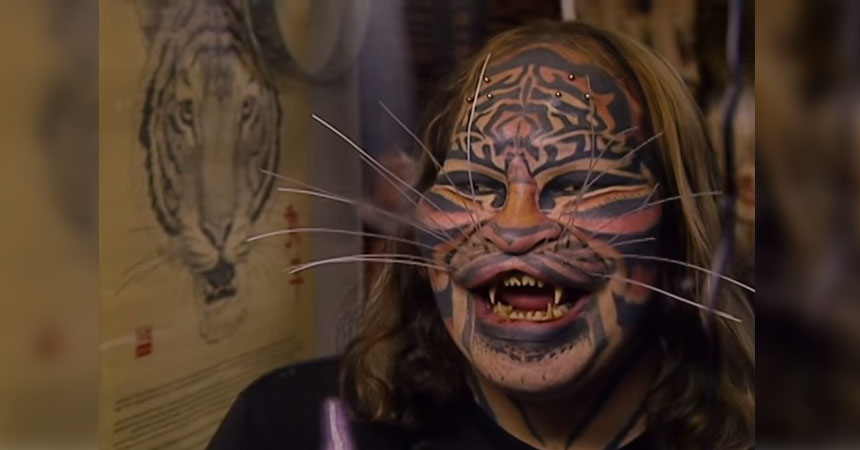 ¿Recuerdas al "Hombre Gato"? Así era antes de sus múltiples cirugías ...