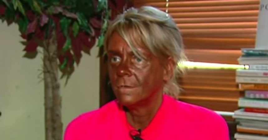 Se hizo famosa en el año 2012 por ser la mujer más bronceada del mundo ...