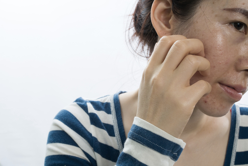 ¿Qué es la dermatitis facticia?