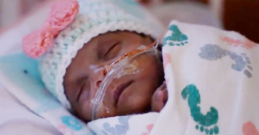 Saybie, la bebé más pequeña del mundo: pesó menos de 250 gramos